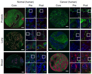 Nanoscale imaging of clinical specimens using pathology-optimized ...