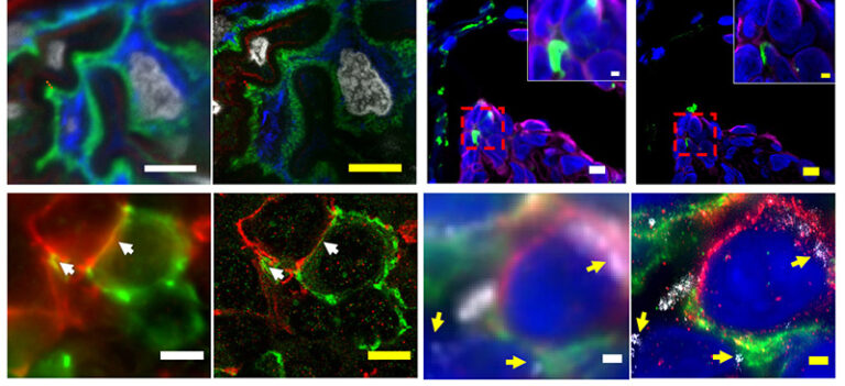 Nanoscale imaging of clinical specimens using conventional and rapid expansion pathology ...