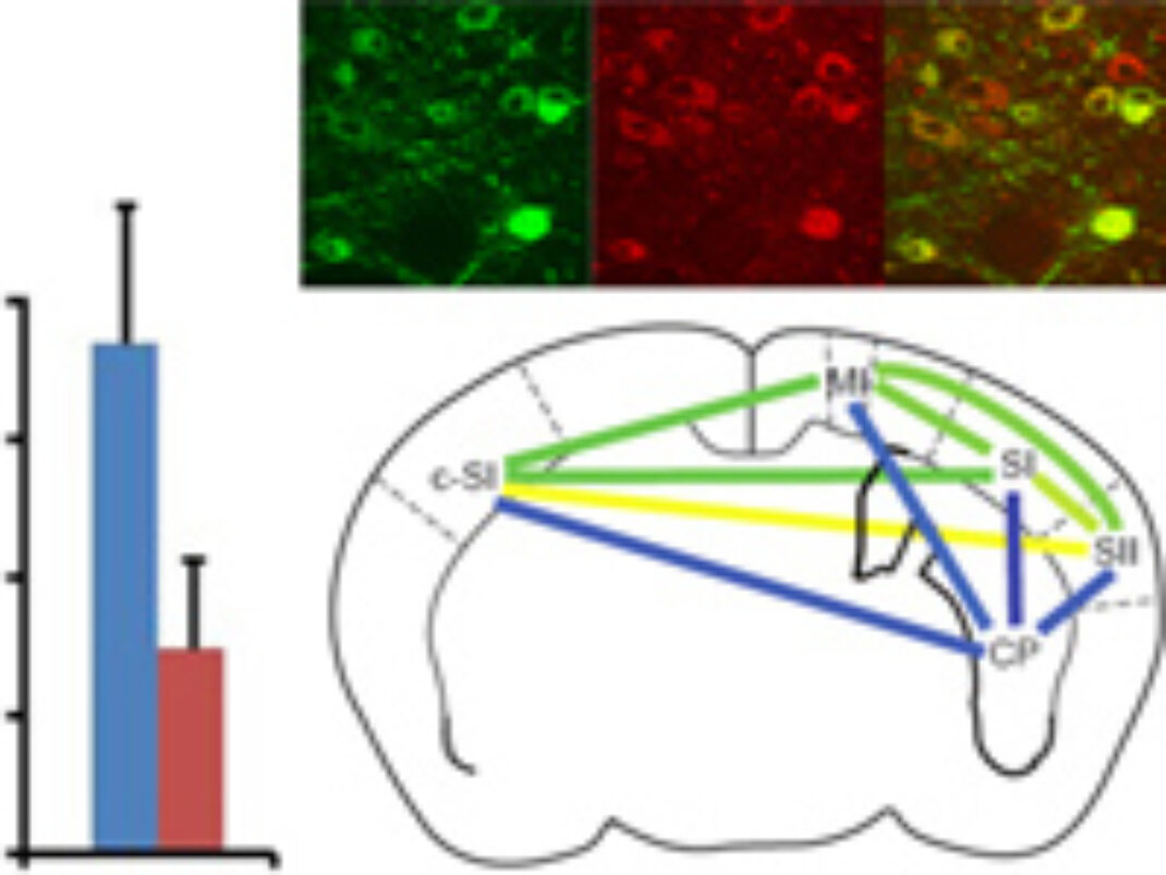 Tools for Analyzing, Repairing, and Simulating the Brain - Synthetic ... Tools for Analyzing, Repairing, and Simulating the Brain - Synthetic ...