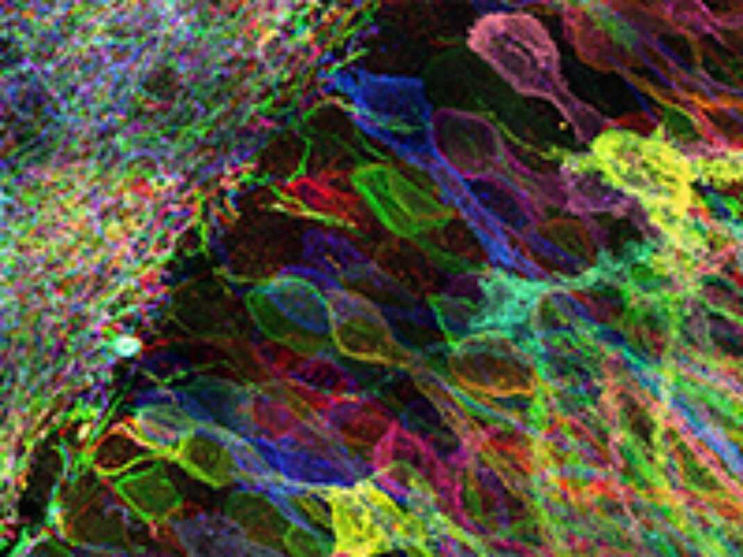 Photo-expansion microscopy enables super-resolution imaging of cells ...