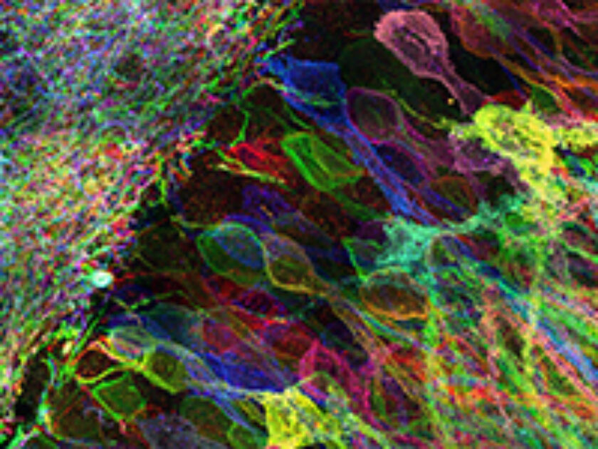 Q&A: Expansion microscopy - Synthetic Neurobiology Group